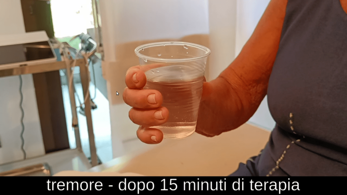 Caso clinico: tremore Pre-Post – Neurologia Funzionale, Chiropratica
